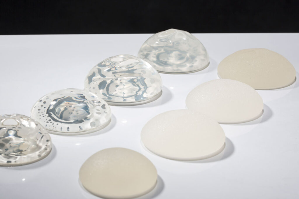 Breast Implants Types: Saline, Silicone & More Options